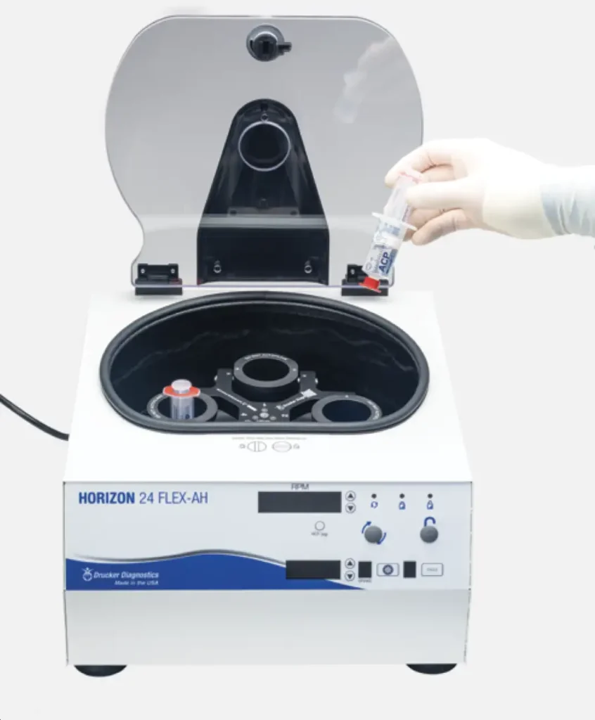 Enhanced PRP™ for Hair Loss - Enhance Skin London